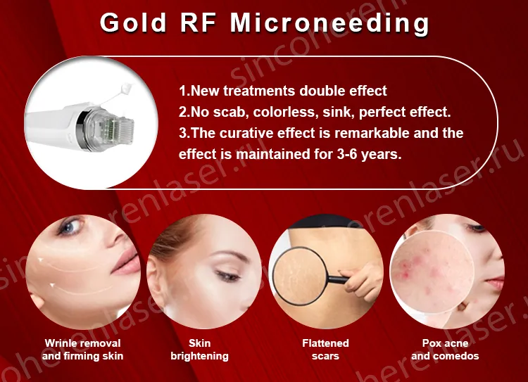 12 Lines 4D Vmax HIFU Liposonix Machine