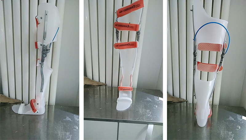 Orthotic knee joint spring lock, It is made of high quality aluminum ...