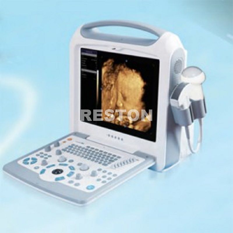 Hand-Carried Color Doppler Ultrasonic Diagnostic System