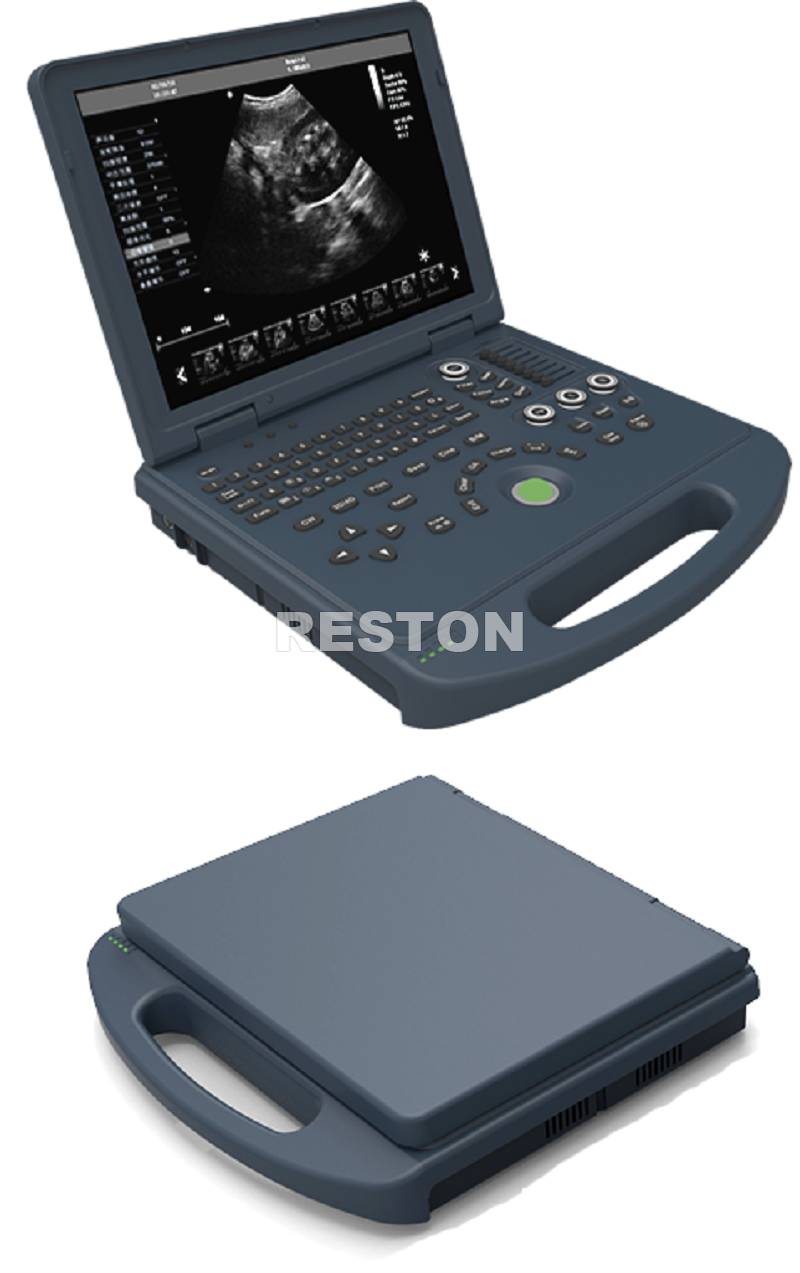 Portable Full Digital Color Doppler Veterinary Ultrasound Diagnostic System
