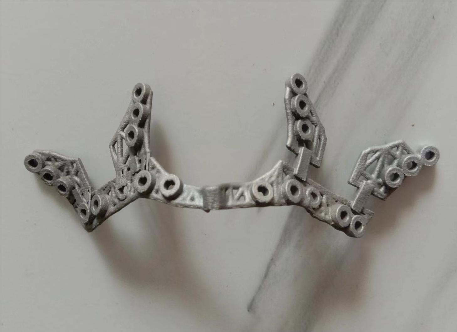 Jaw Surgery Titanium Plates - Example 1