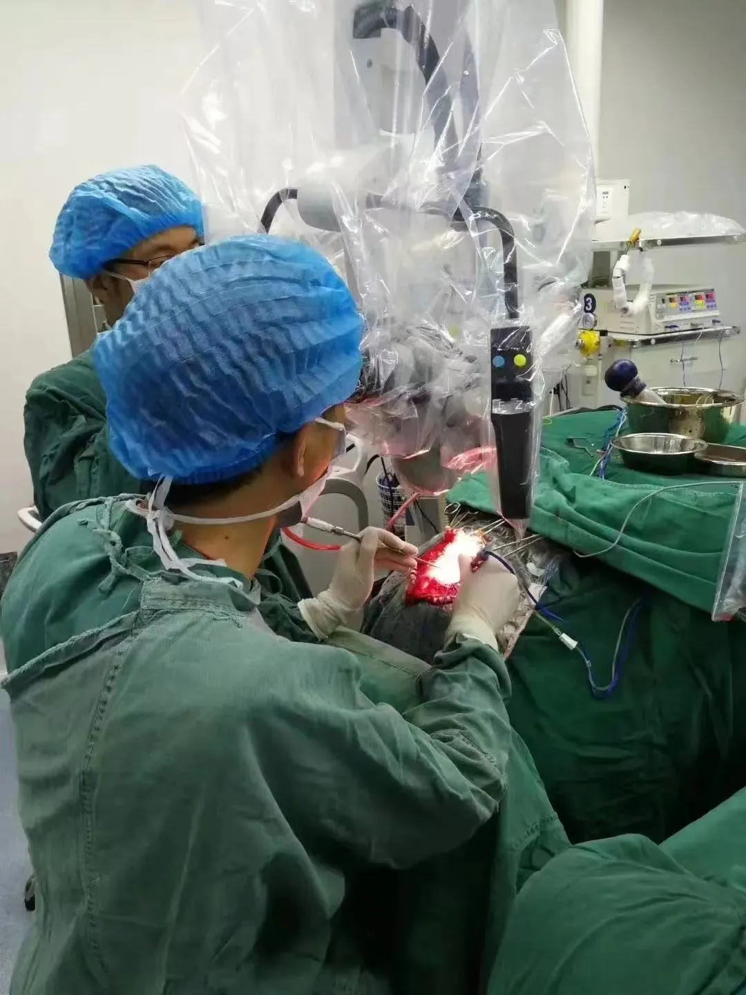 How to repair skull injuries using 3D printed PEEK implants