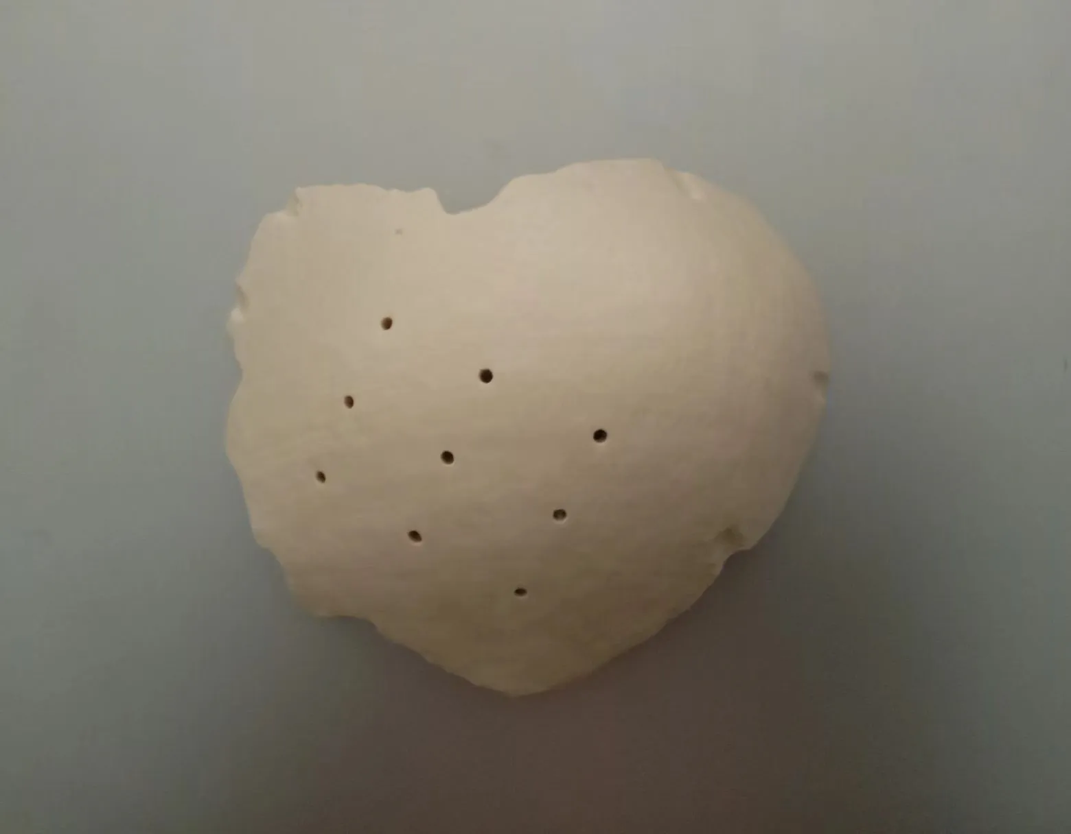 Example of cranioplasty-53: 3D printing PEEK cranial mesh implant