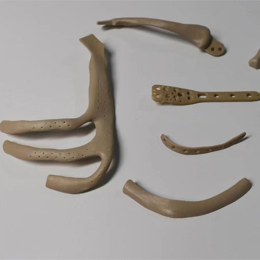 3D Printed PEEK Sternum Ribs-TOPYOUTH3D