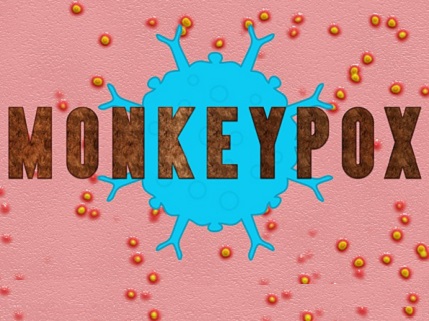 monkeypox, rapid tests, diagnosis, infection, virus, antigen test ...