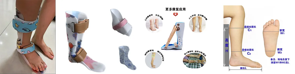 Custom Prosthetic Solutions