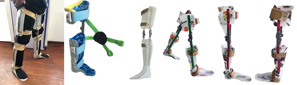 Custom Prosthetic Solutions