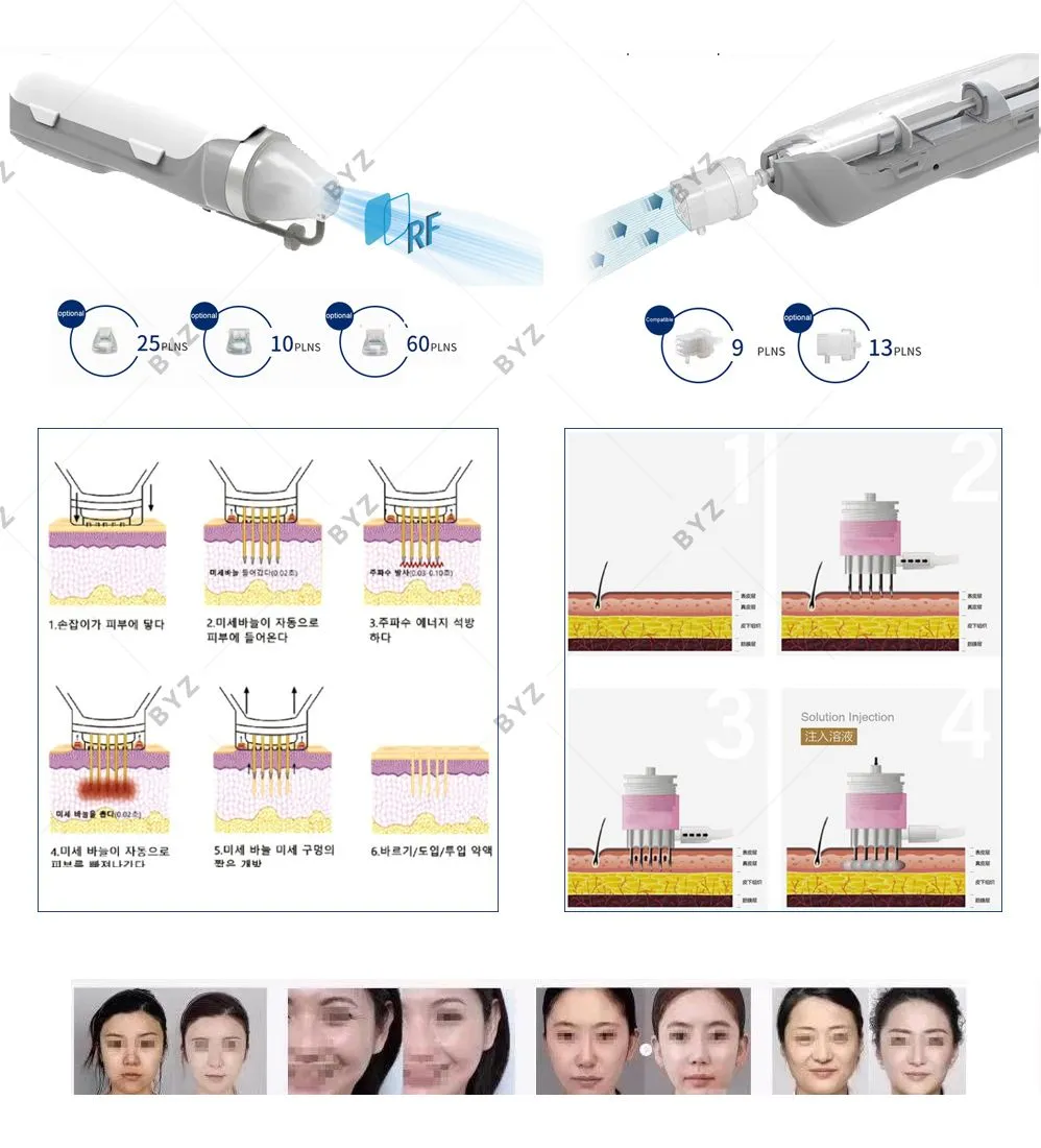 rf microneedle machine