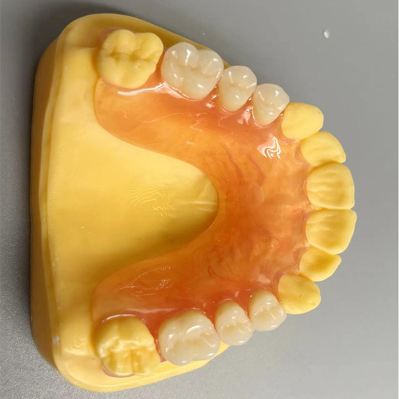 E.AX Veneer Exporter, Ultimate Dental Laboratory