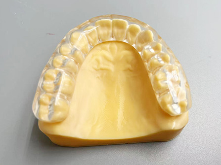 What does an orthodontic retainer do?