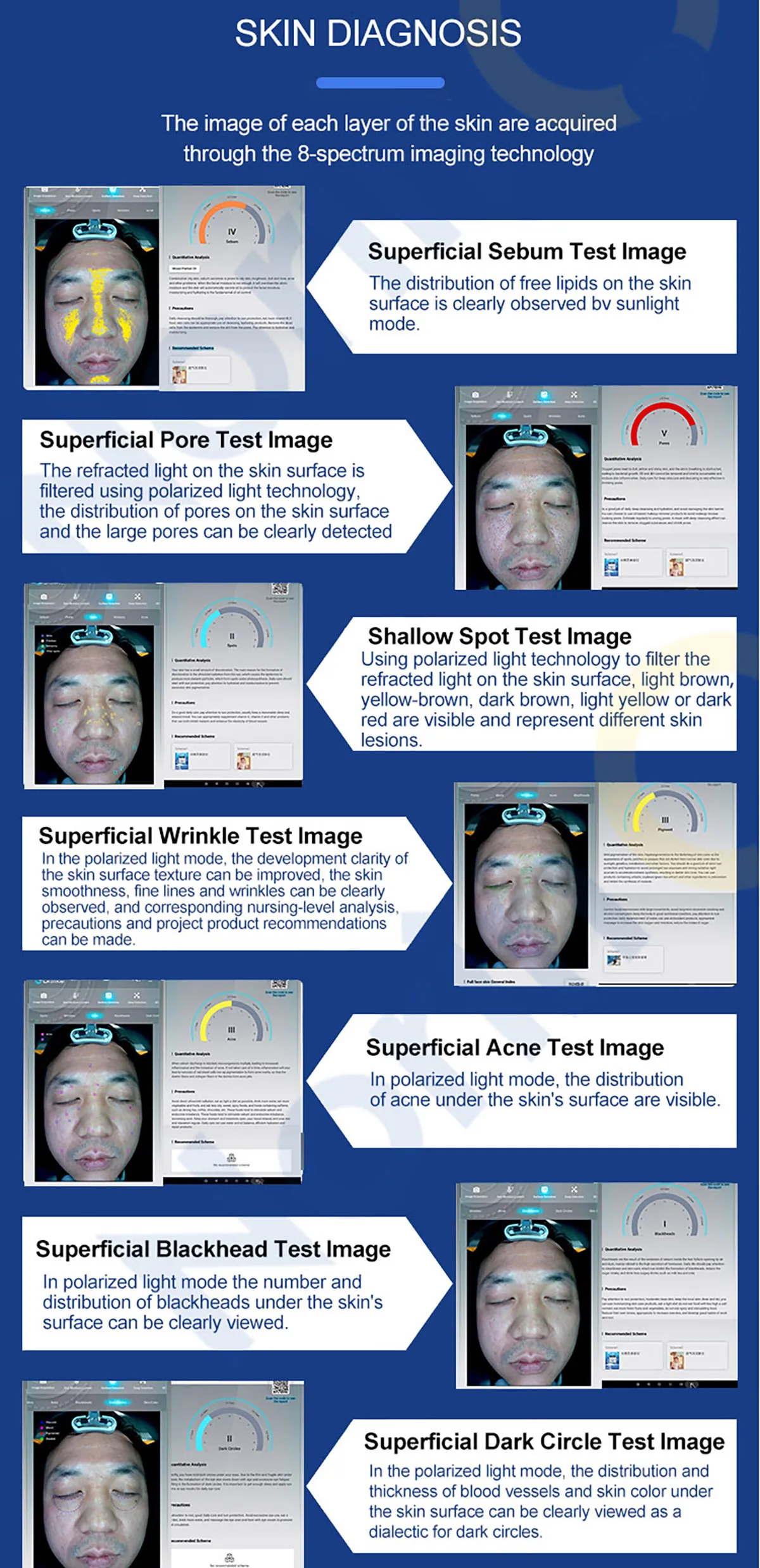 3d face skin analyzer machine