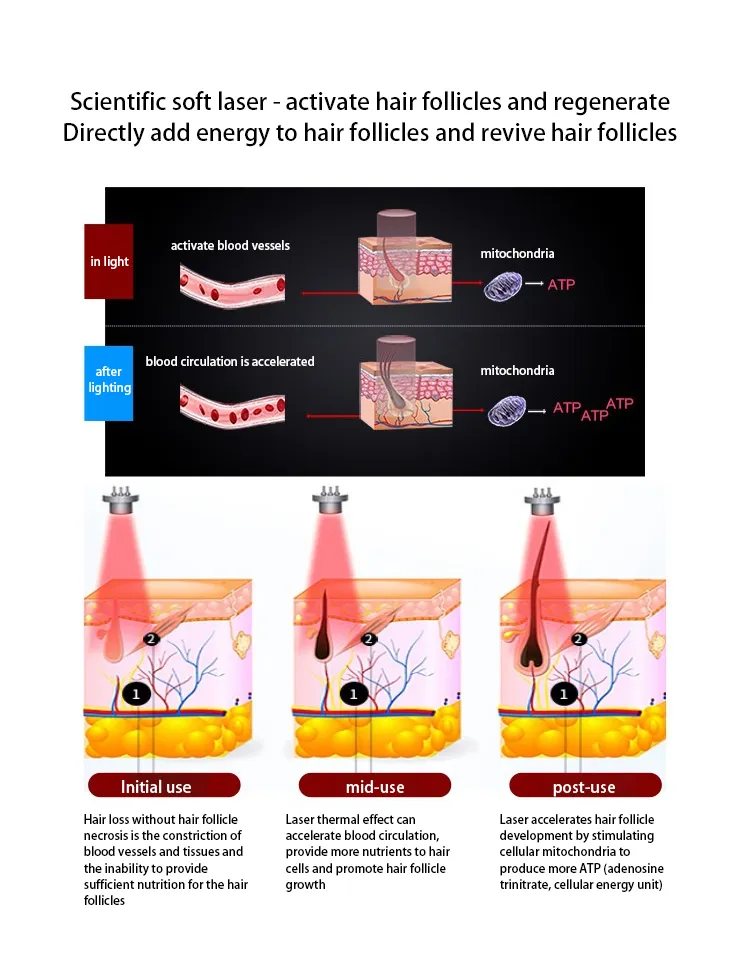 Popular Hair Loss Treatment Laser Hair Regrowth Machine For Salon