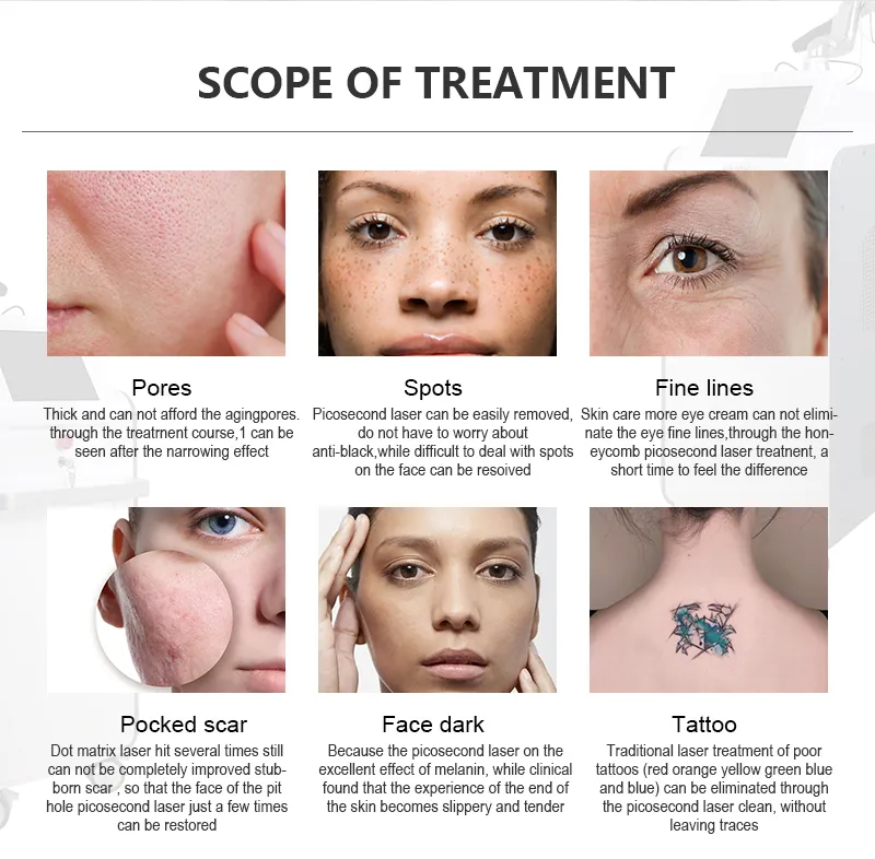 Picosecond Laser Beauty Machine for Skin Rejuvenation