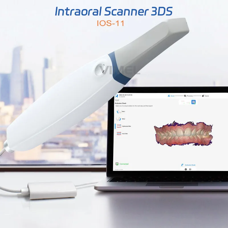 Runyes V3 Pro Dental 3D Intraoral Scanner