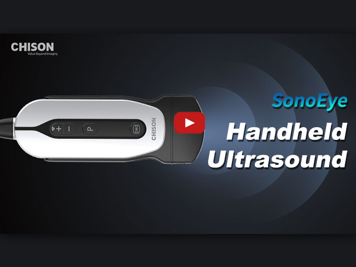 Handheld Ultrasound Machine Price , Buy Portable Ultrasound,portable ...