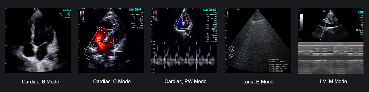 Handheld ultrasound system for POCUS, used in cardiology, portable and ...
