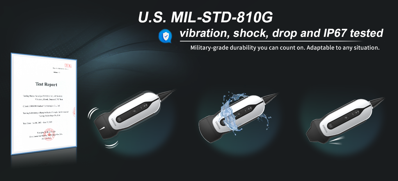 The Point-of-Care Ultrasound (POCUS) Revolution