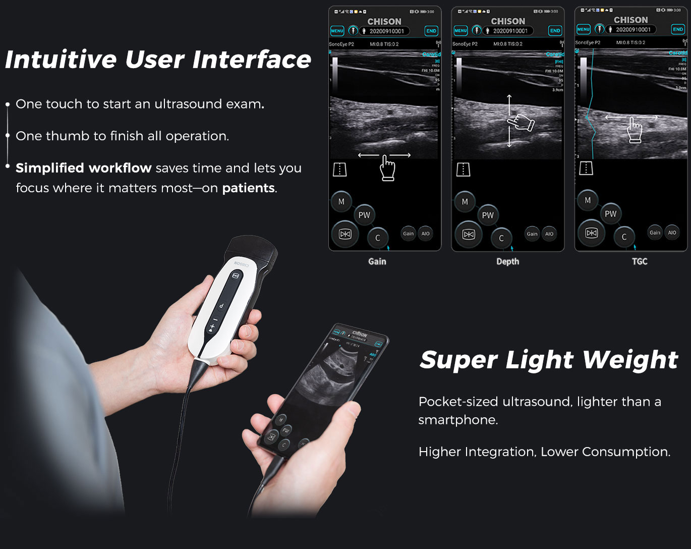 Cost-effective handheld ultrasound SonoEye, easy to use and durable