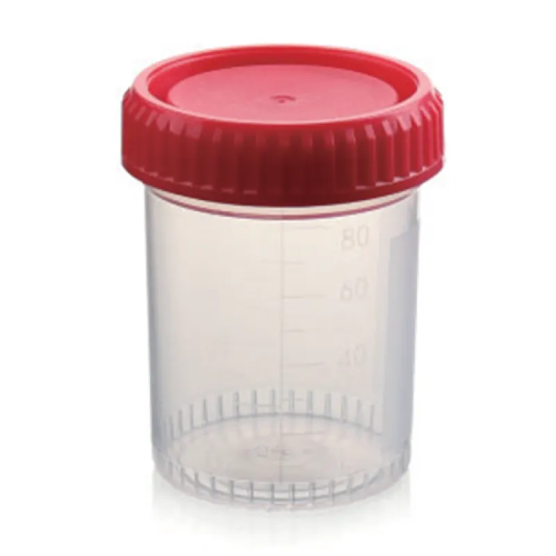Specimen Container,Urine Container,Stool Sample Container
