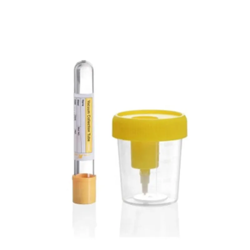 Vacuum Urine Container,Vacuum Urine Tube,Vacuum Urine Cups