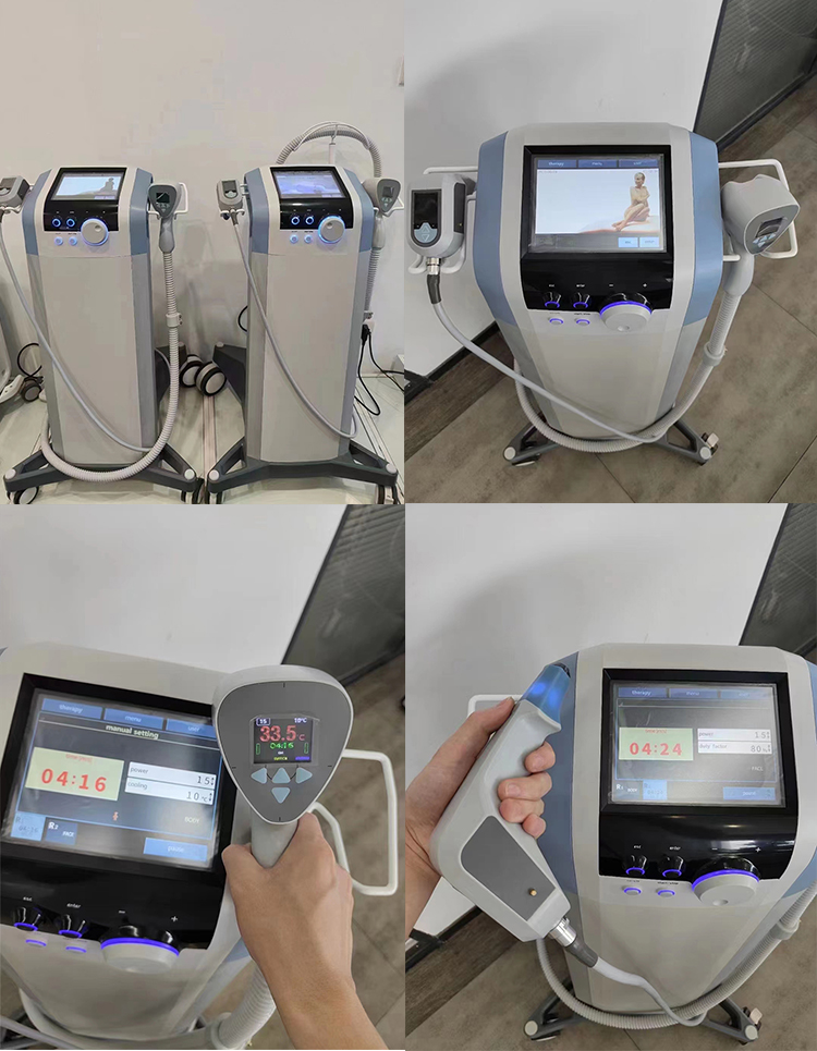 Ultra 360 Exilis Elite Skin Tightening Device