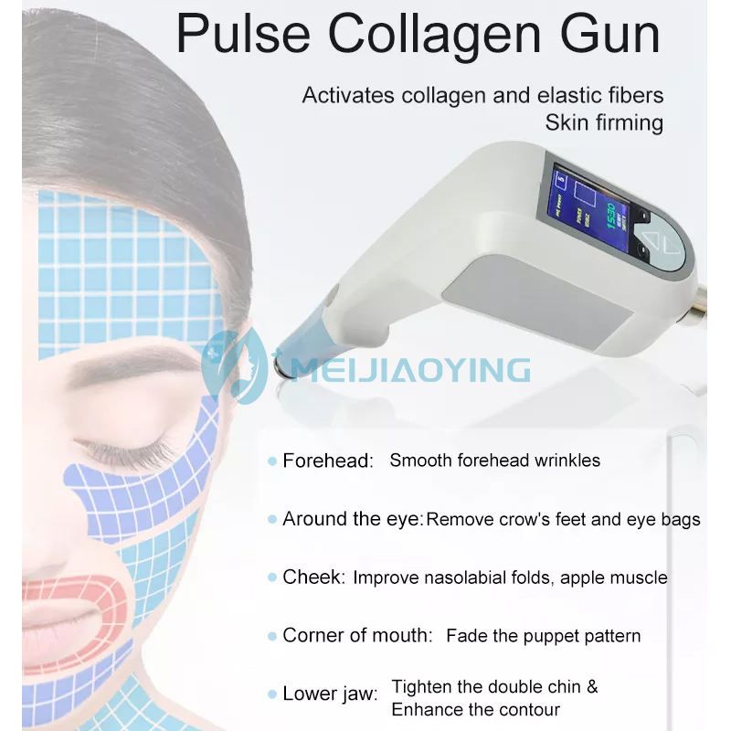 Ultra 360 Exilis Elite Skin Tightening Device