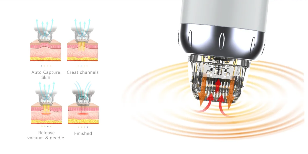 Portable Microneedling Radiofrequency Vacuum RF Machine