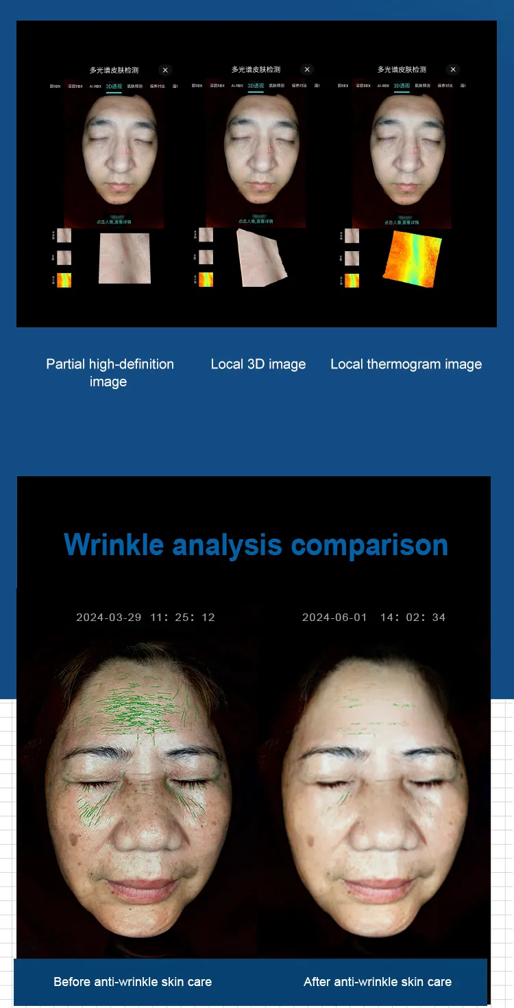 AI Skin Analyzer Skin Tester Machine