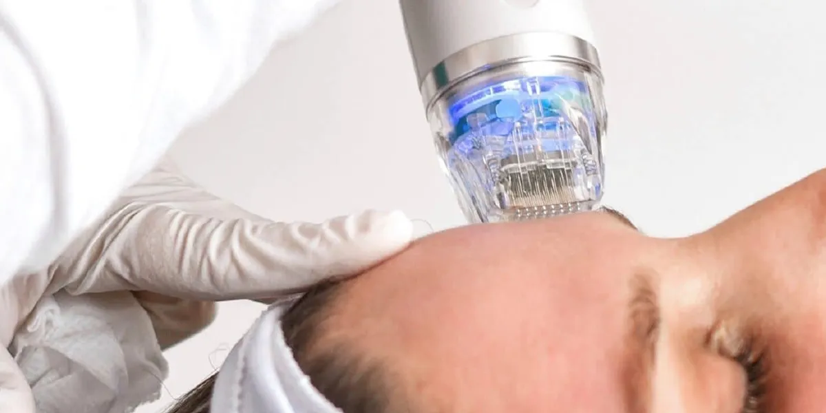 RF Microneedling Fractional Skin Lifting and Tightening Anti-Aging Machine