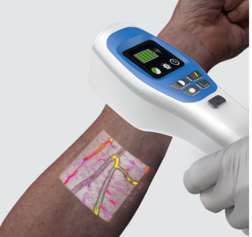 Encuentra Venas con Tecnología de Color para Uso Médico y Estético