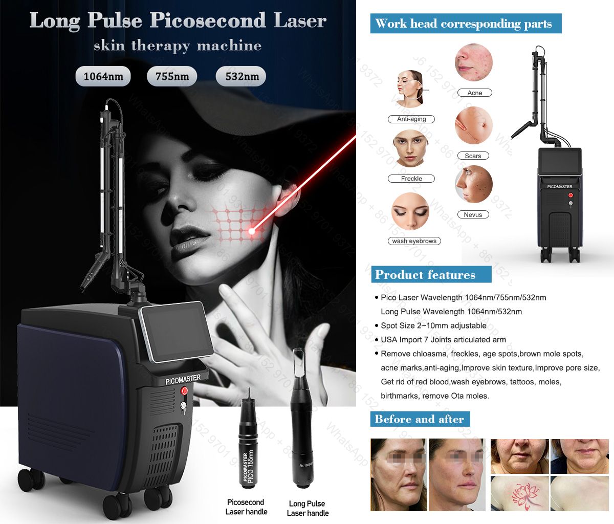 Picosecond Laser Machine