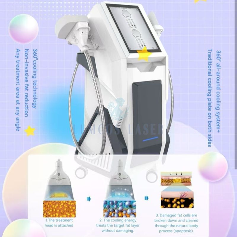 Fat Freezer,cryopolisis