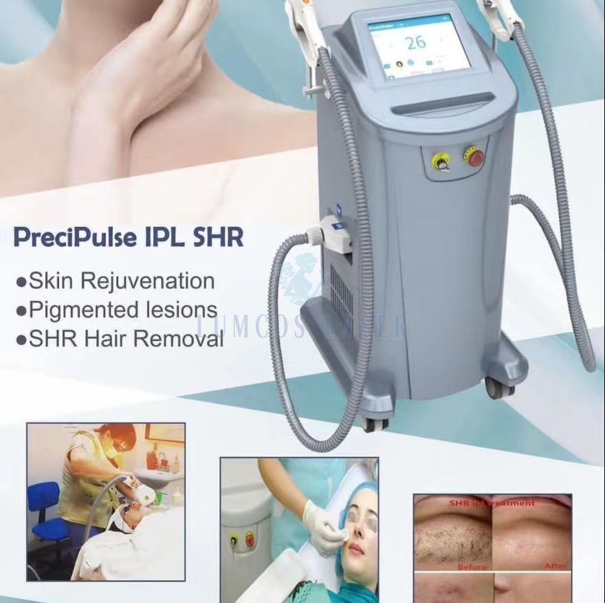 IPL, IPL skin Rejuvenation