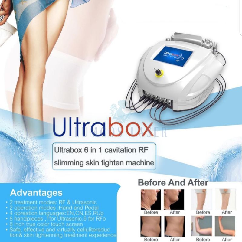 cavitation and radio frequency, rf cavitation,cavitation 40k