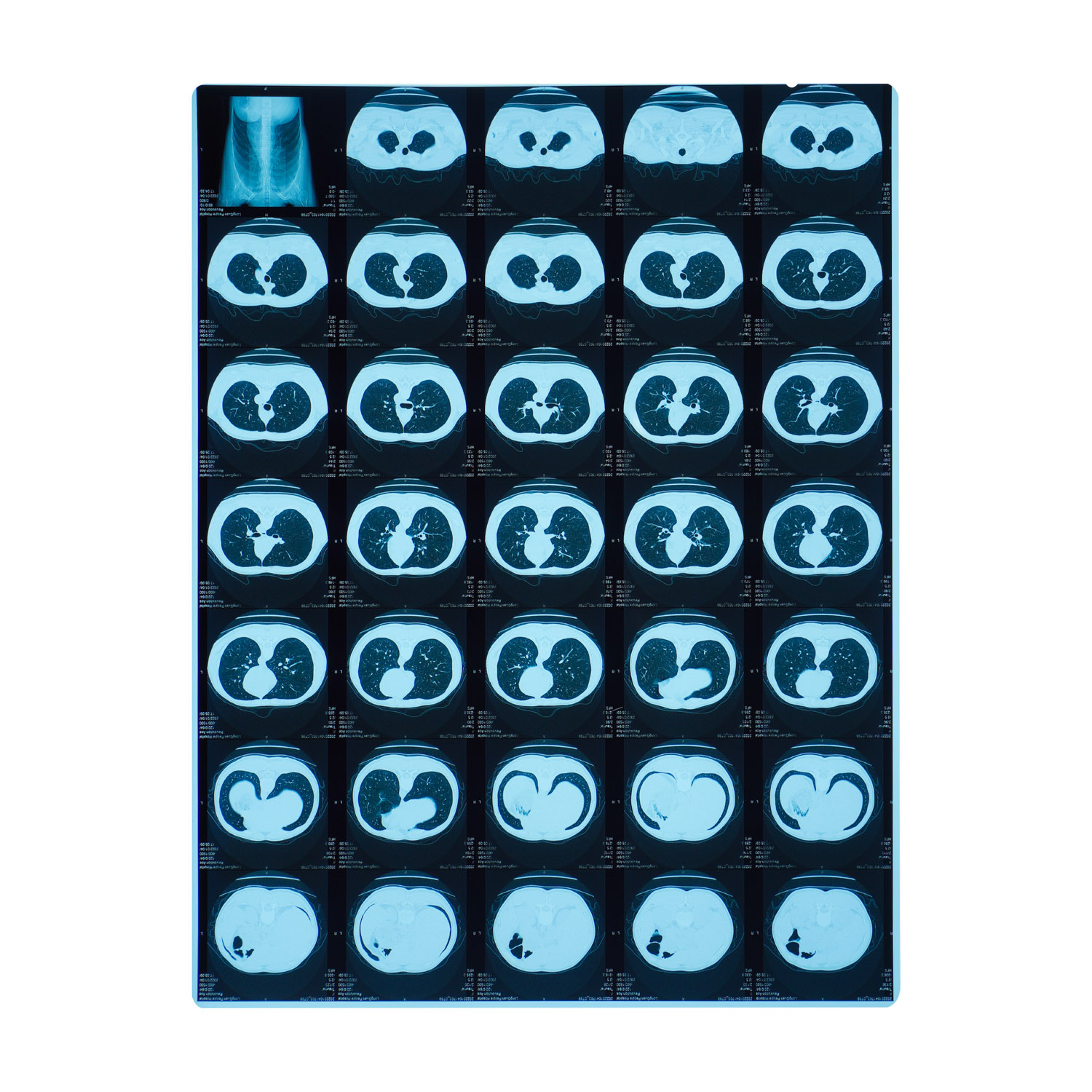 Medical Printers, Dry Imaging Printers, Thermal Medical Printers