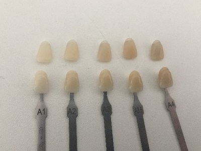 produits dentaires en matériau pmma multicouche une série