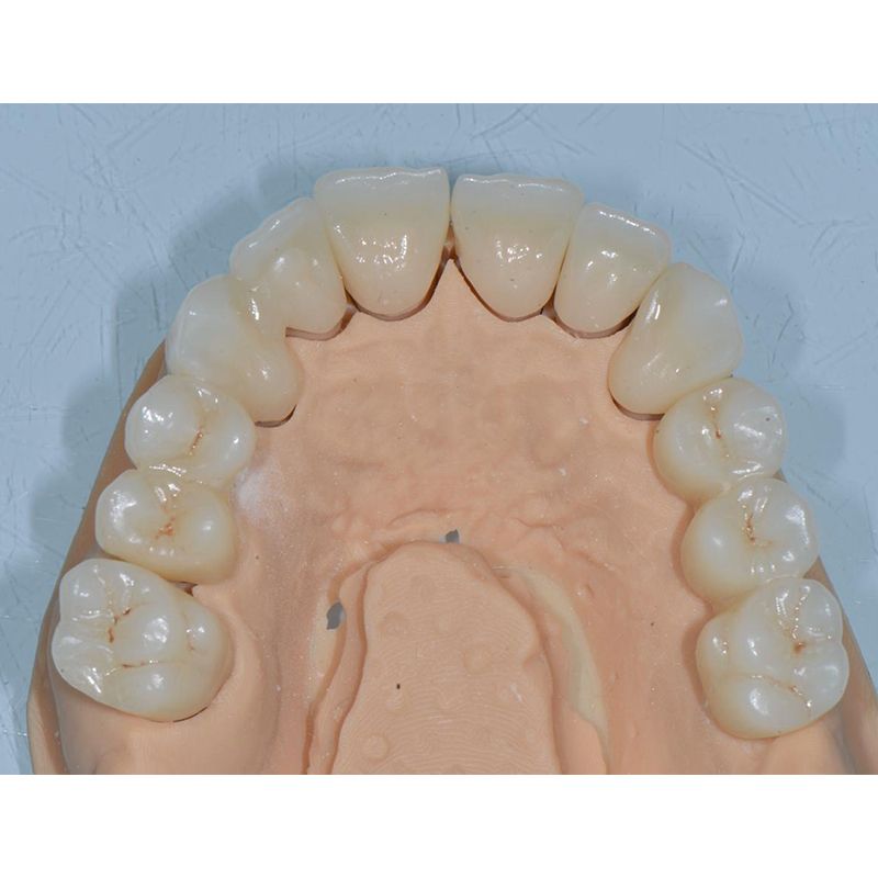 Cad Cam Dentistry