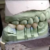 Color Zirconia Blocks