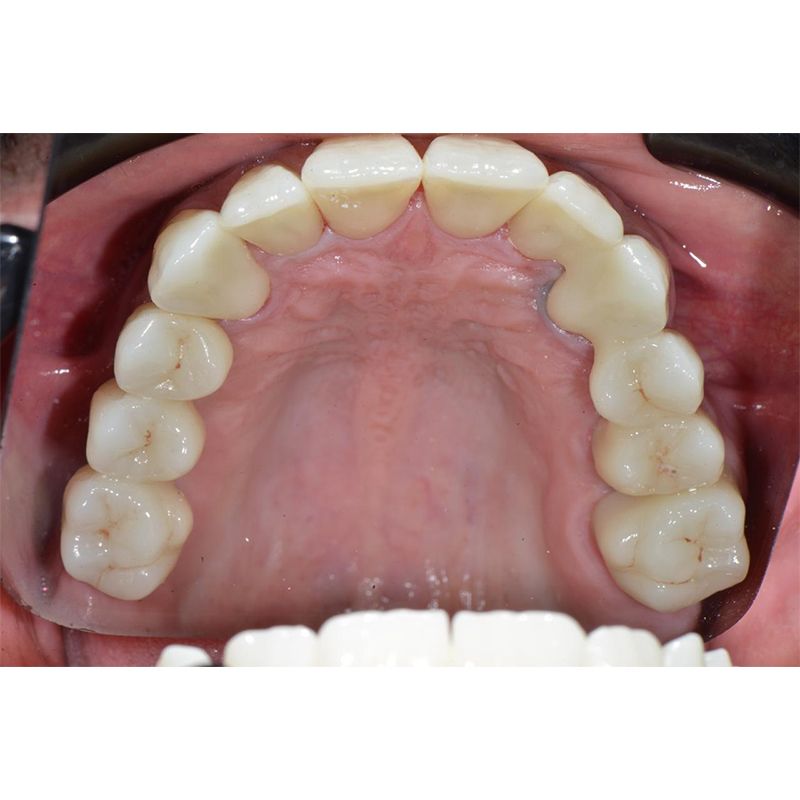 Cad Cam Dentistry